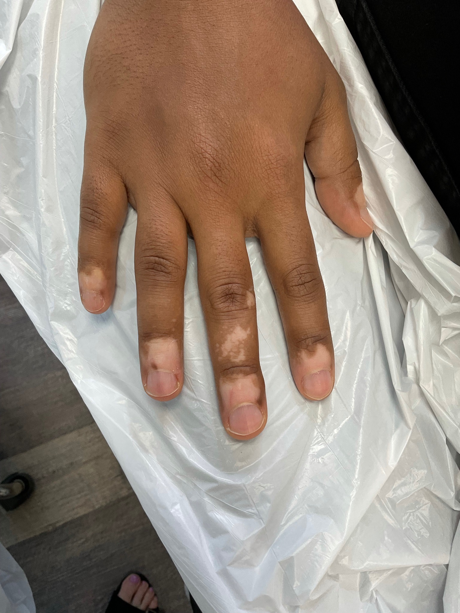 Why PMU artists must learn Scar & Trauma services now... | Vine Studios